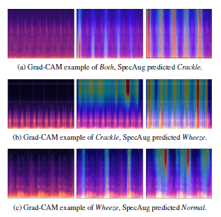 GaP-aug: Gamma Patch-Wise Correction Augmentation Method for ...